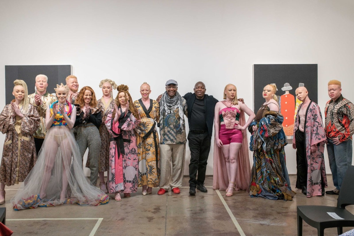 NATF Celebrates International Albinism Awareness Day in Tshwane ...