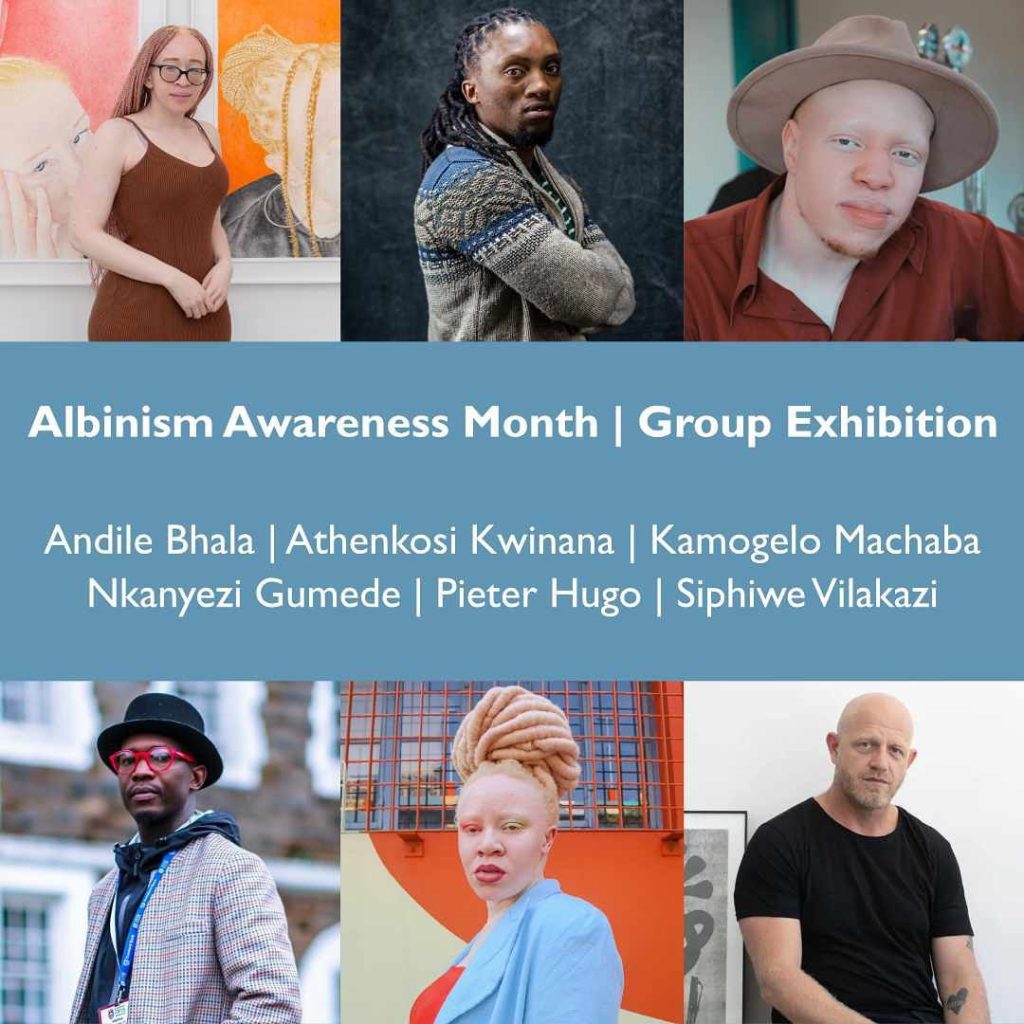 Unveiling Albinism in Art: 'Ndijongile' Exhibition at Berman ...