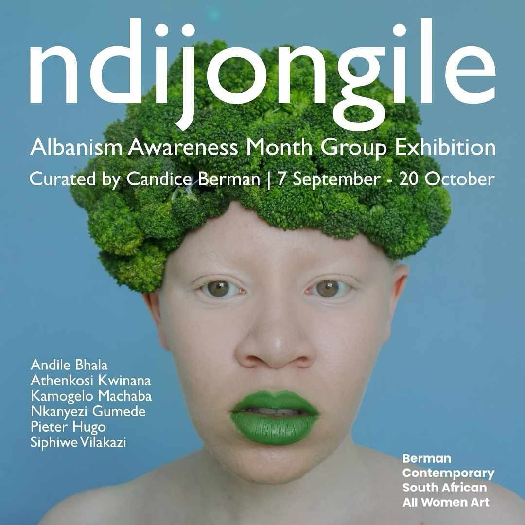 Unveiling Albinism in Art: 'Ndijongile' Exhibition at Berman ...
